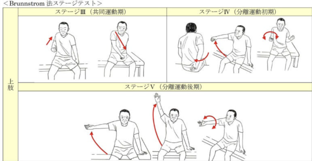 【麻痺の評価：上肢編】ブルンストロームステージの覚え方と考え方 – START REHA